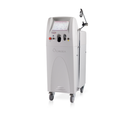 Candela VBEAM PERFECTA імпульсний лазер на барвнику купити, краща ціна ...